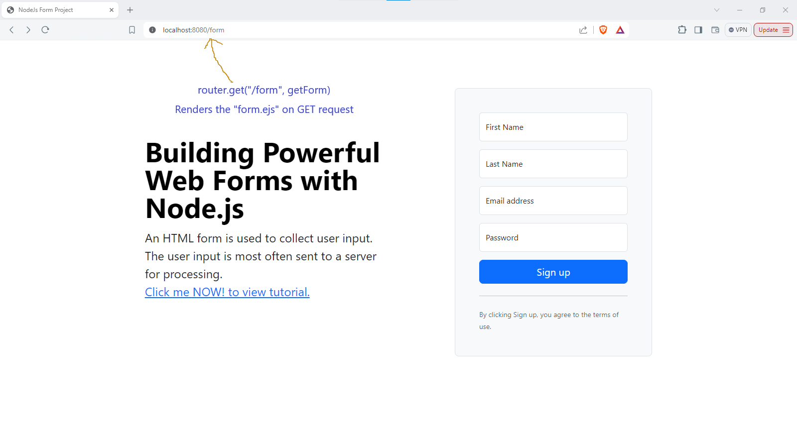 Build Powerful Web Form with Node.js (Step-by-Step Guide) - Zeenom Technologies